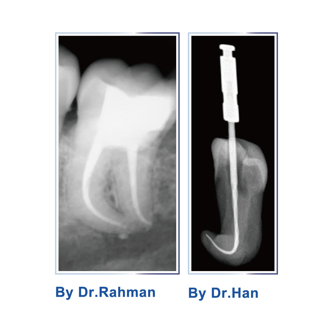 C-Root Heat-Treated Rotary Ni-Ti Files – C-Root Dental Medical